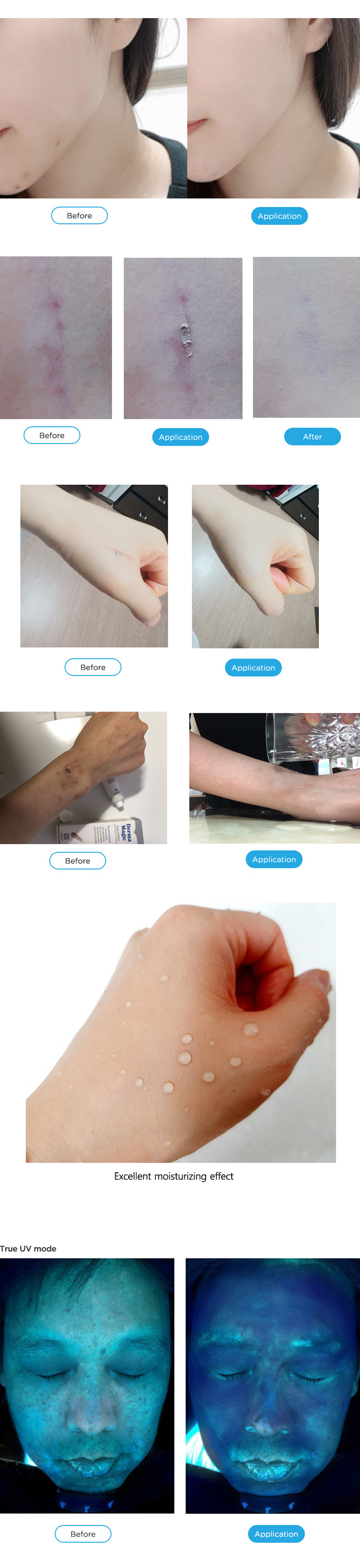 Before and After Photos – 더마매직 – 인터내셔널 홈페이지 | DERMAMAGIC International ...